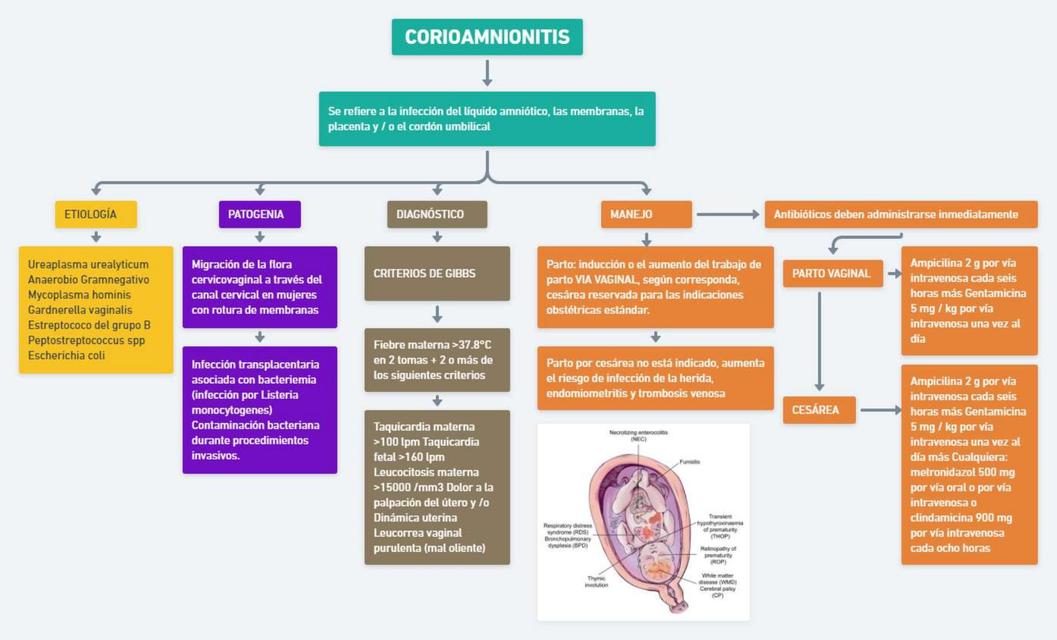 Corioamnionitis | Stefy Aldas | uDocz