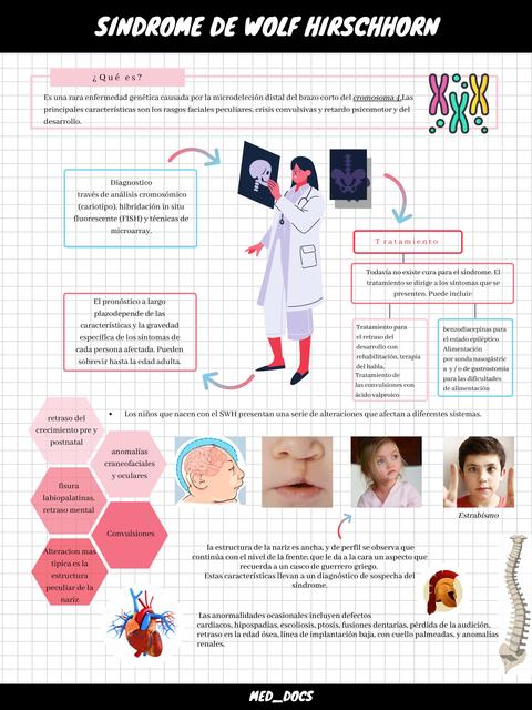 Síndrome de Wolf Hirschhorn | Med_Docz | uDocz