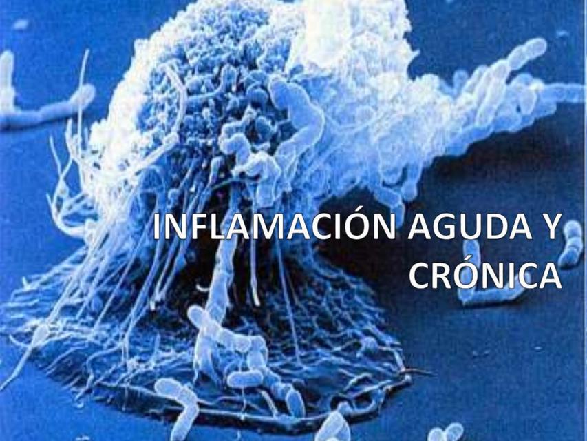 Inflamación Aguda y Crónica | Apuntes y Resúmenes médicos | uDocz