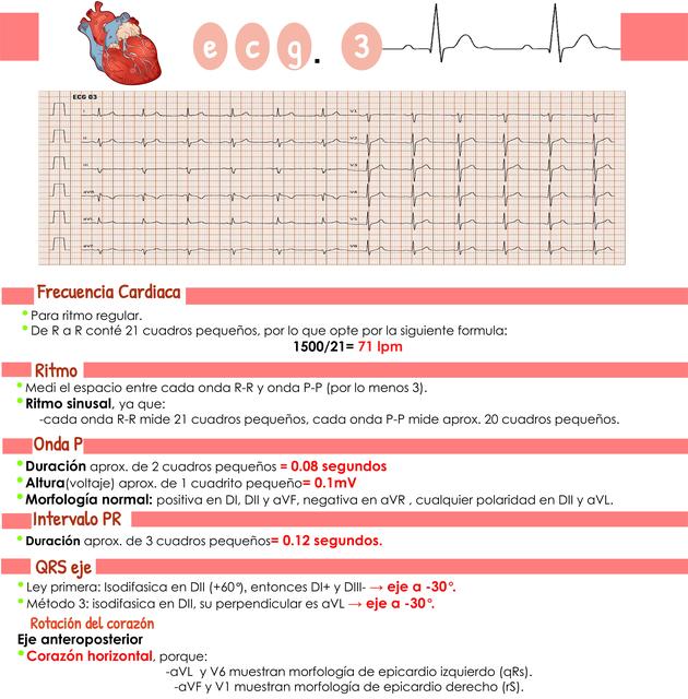 Lectura de ECG | DOCTORINE | uDocz