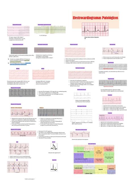 Resúmenes de Electrocardiograma normal | Descarga apuntes de ...
