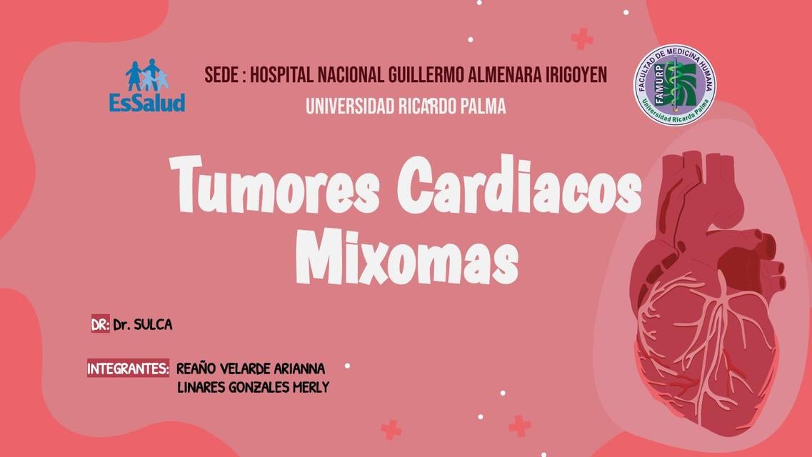 Tumores Cardiacos Mixomas | Sabiduría Médica | uDocz