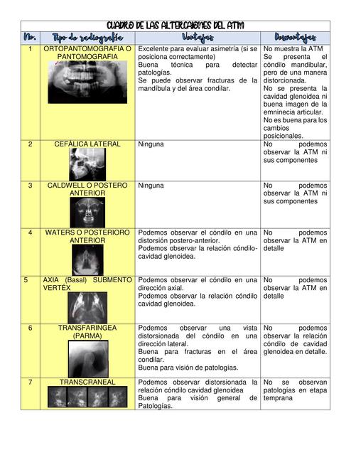 Cuadro de Alteraciones del ATM | Ivonne Albavera | uDocz
