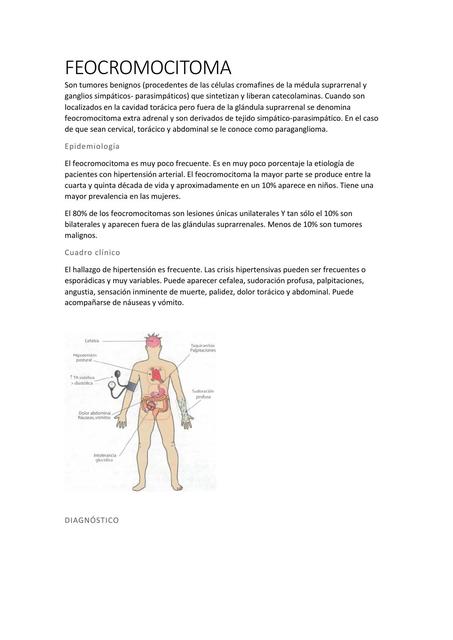 Feocromocitoma | Juan Diego Aguilar León | uDocz