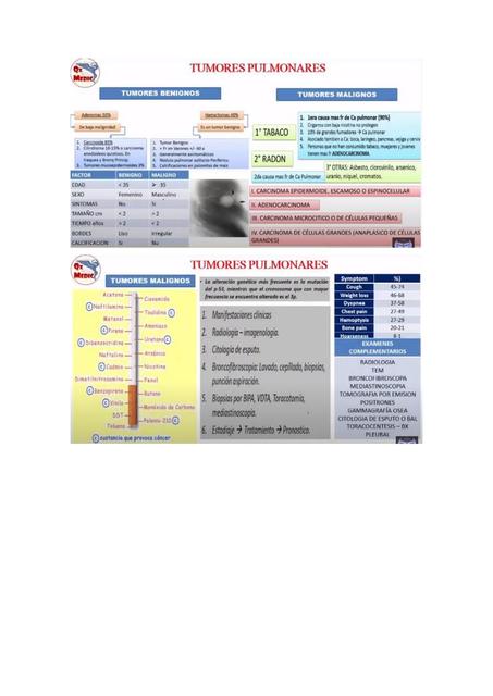 Tumores pulmonares | mariana Ninapaytan | uDocz
