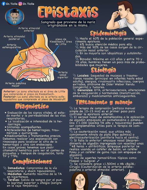 Epistaxis | Jhan Carlos Ticlla Mori | uDocz