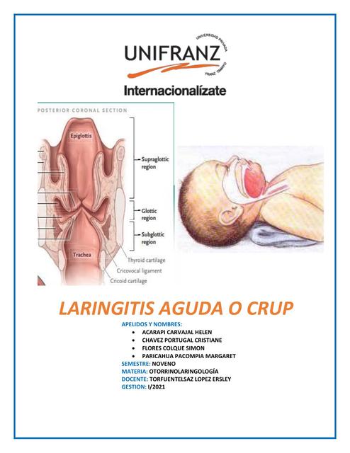 Laringitis Aguda | Rosario Carvajal | uDocz