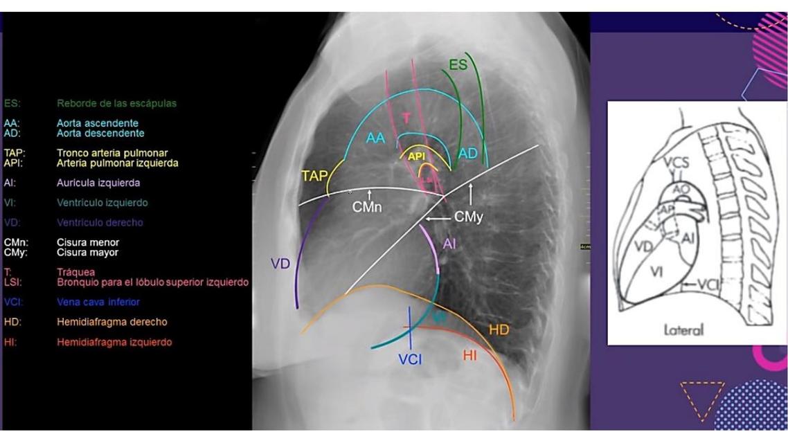 RX Pulmón | JOSE ARELLANES | uDocz