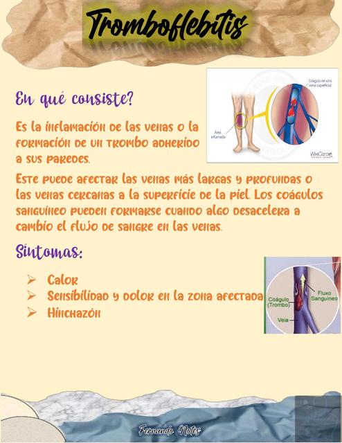 Tromboflebitis | Fernando Eslaquit | uDocz