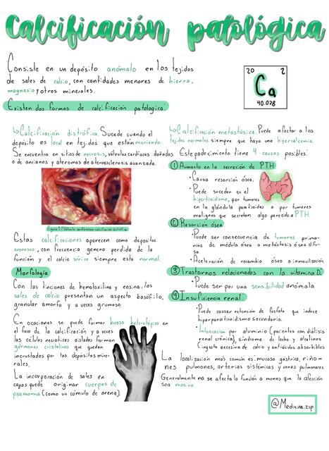 Calcificación Patológica | Medicina.zip | uDocz