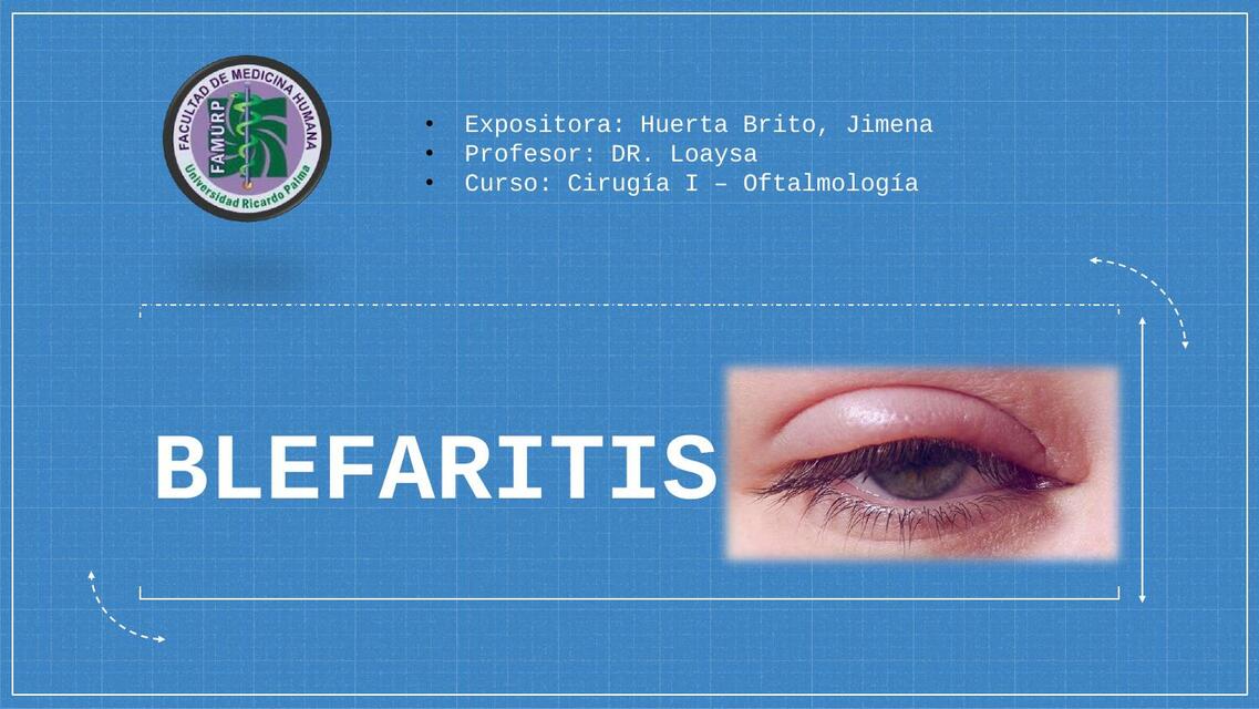 Blefaritis | Jimena F. Huerta Brito | uDocz