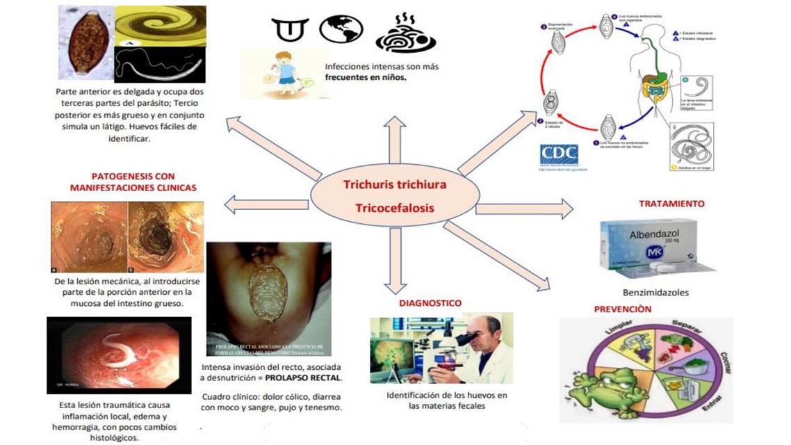 Trichuris Trichiura | Bruno Hernandez | uDocz