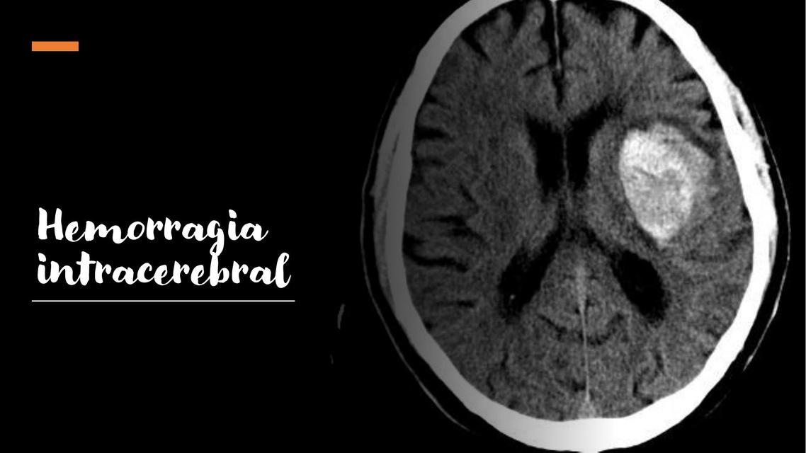 Hemorragia Intracerebral | Crismeily Figueroa | uDocz