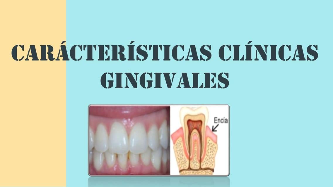 Características Clínicas Gingivales | Tati Dent | uDocz