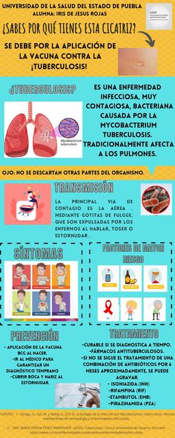 Tuberculosis | Iris De Jesus Rojas | uDocz
