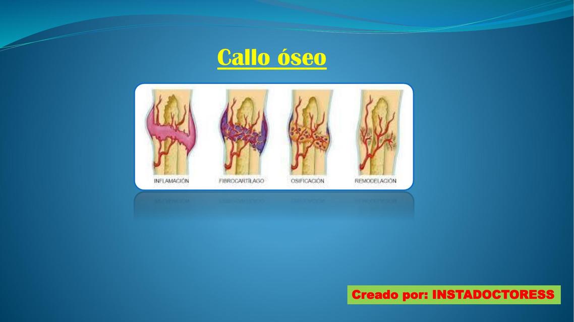 Callo óseo | Instadoctoress | uDocz
