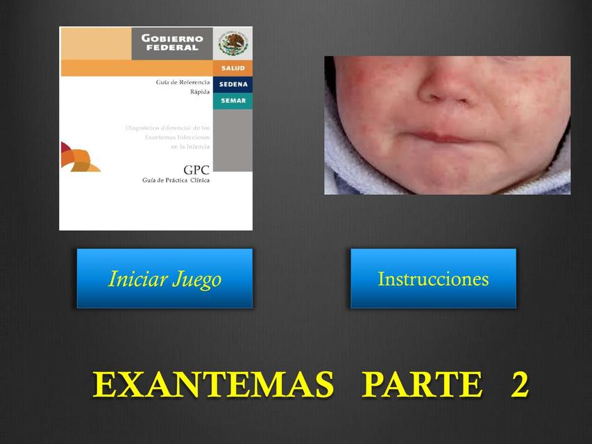 Exantemas | Dulce Cortes | uDocz