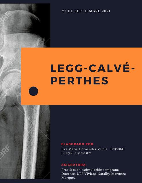 Enfermedad de legg calve perthes | Eva Hernandez | uDocz