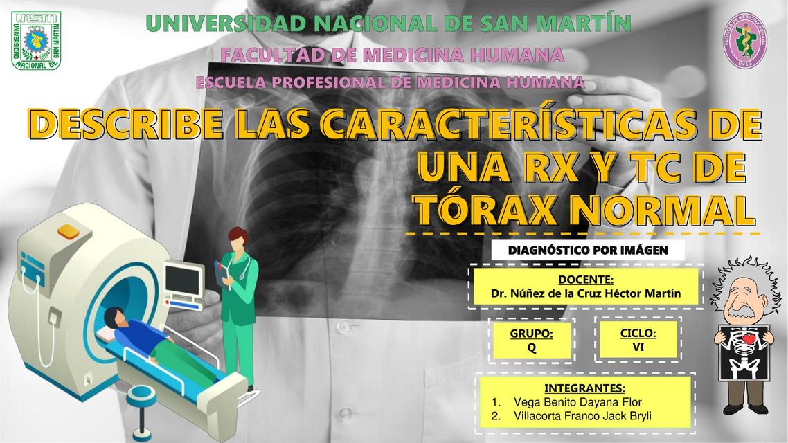 Características de una Rx y Tc de Tórax Normal | Dayana Flor Vega ...
