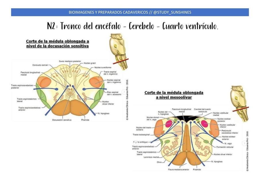 Tronco del encéfalo - Cerebelo - Cuarto ventrículo.