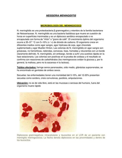 Neisseria Meningiditis