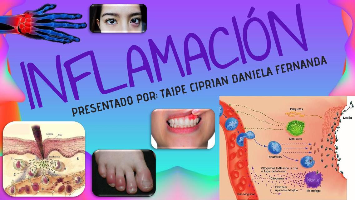 Inflamación | Daniela Fernanda Taipe Ciprian | uDocz