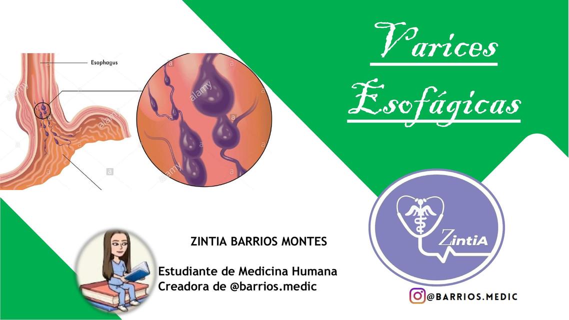 Varices esofágicas | BARRIOS MEDIC 👩‍⚕️📚 | uDocz