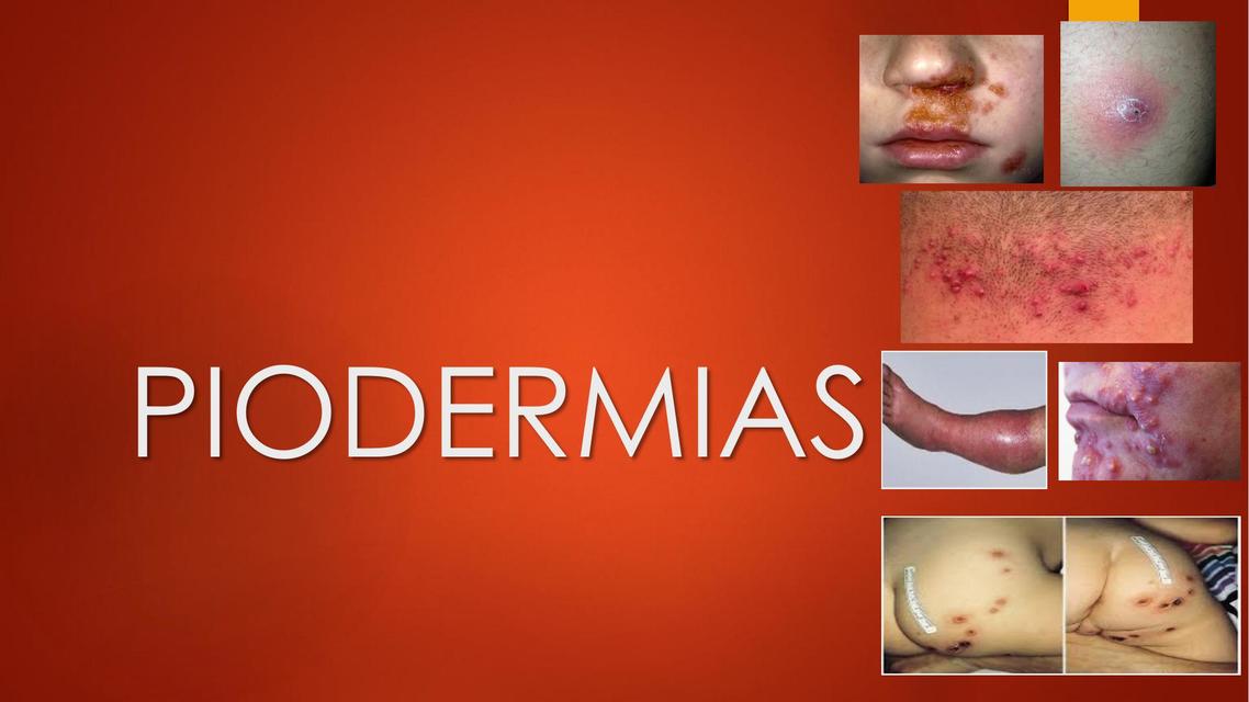 Piodermias | Jhosselin Rodriguez Morato | uDocz