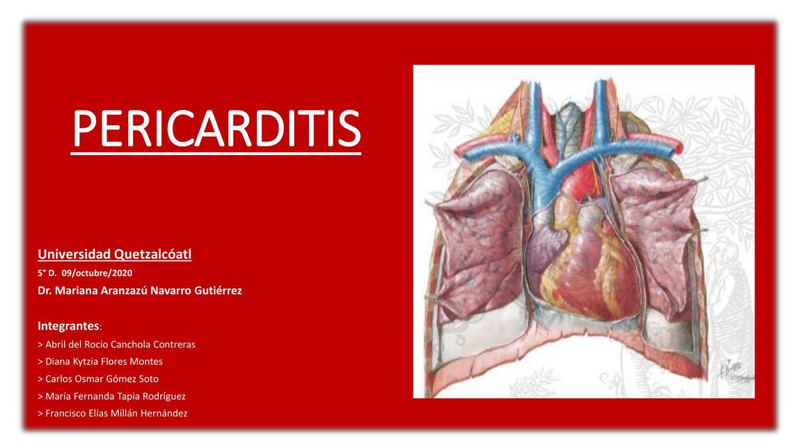 Pericarditis | Mariano Calderón | uDocz