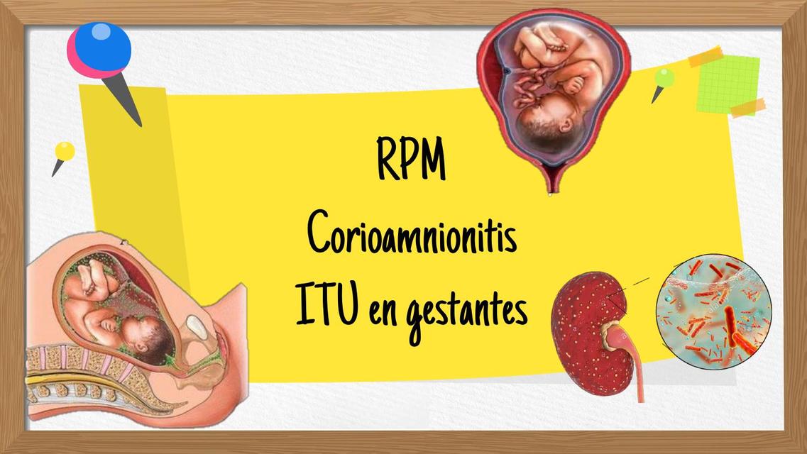 Resúmenes de Corioamnionitis | Descarga apuntes de Corioamnionitis
