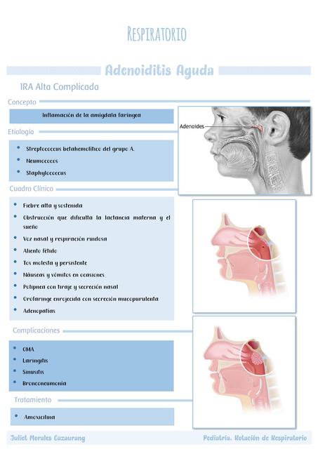 Adenoiditis Aguda | Juliet Morales Cazaurang | uDocz