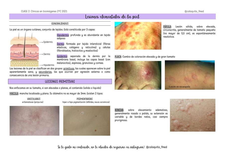 CLASE 2 Lesiones elementales de la piel | Calaquita Study | uDocz