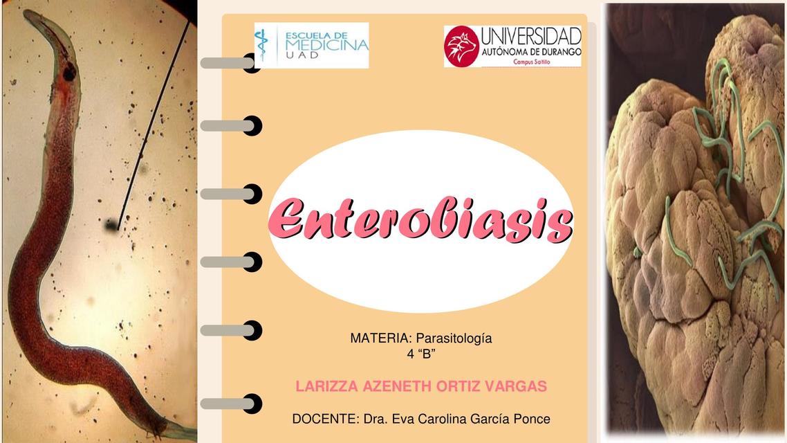 Enterobiasis | Larizza Azeneth Ortiz Vargas | uDocz