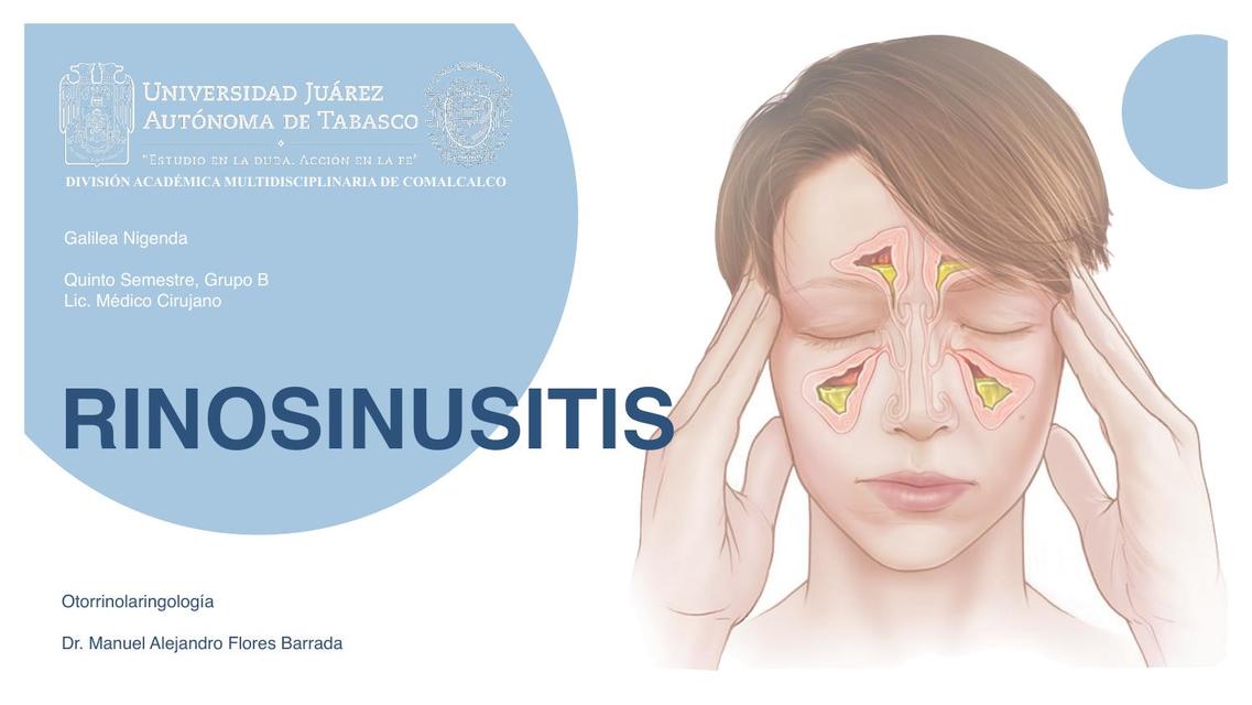 Rinosinusitis | Galilea N | uDocz