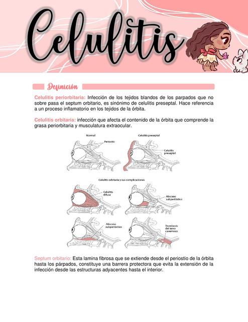 Celulitis | Juanita Zapata | uDocz