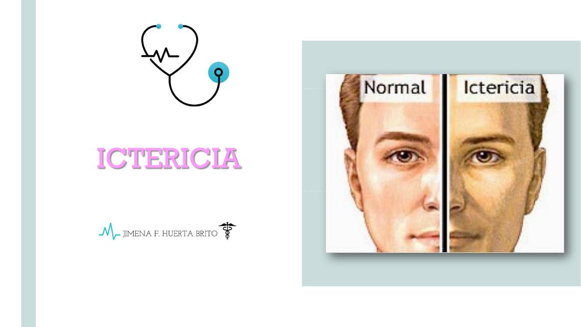 Resúmenes de Tipos de ictericia | Descarga apuntes de Tipos de ictericia