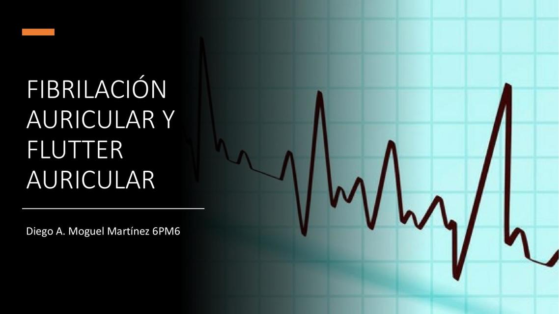 Fibrilación Auricular y Flutter Auricular | Diego Moguel | uDocz
