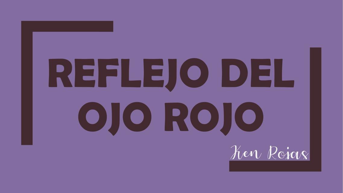 Reflejo del Ojo Rojo | Ken Rojas | uDocz