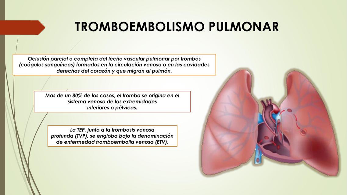 Tromboembolismo Pulmonar Maria Chirinos UDocz Tromboembolismo Pulmonar Maria Chirinos UDocz