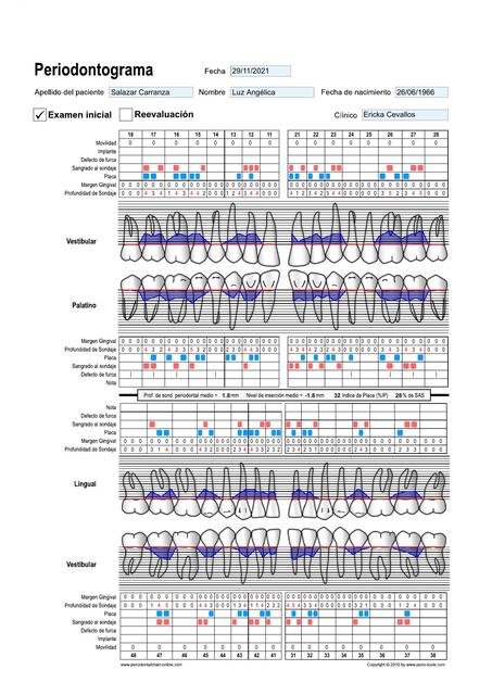 Periodontograma Periodontal Chart Plantilla Odontolog - vrogue.co Periodontograma Periodontal Chart Plantilla Odontolog - vrogue.co
