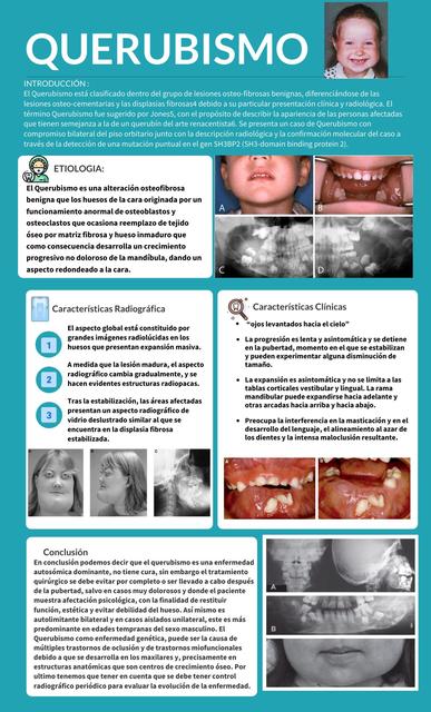 Resúmenes de Querubismo | Descarga apuntes de Querubismo