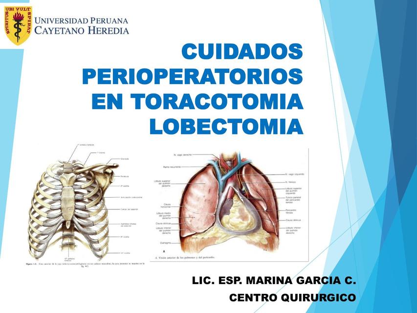 Cuidados Perioperatorios en Lobectomia | Eunice Hamilton | uDocz