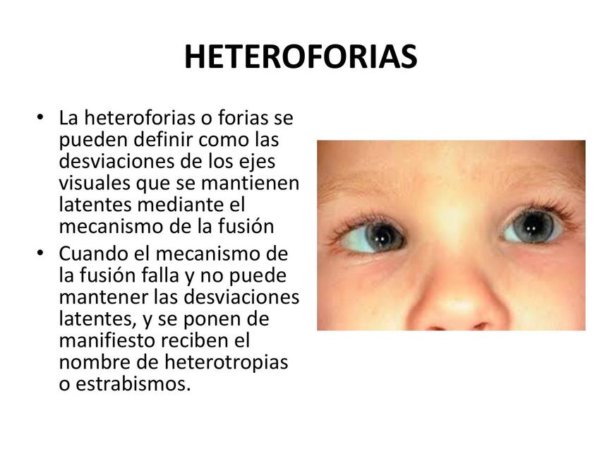 Oftalmología | Nicole Soliz | uDocz