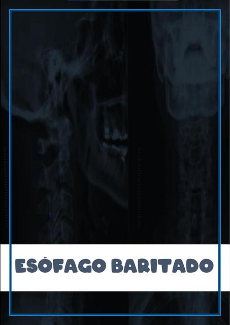 Esófago Baritado | Breenstudy | uDocz