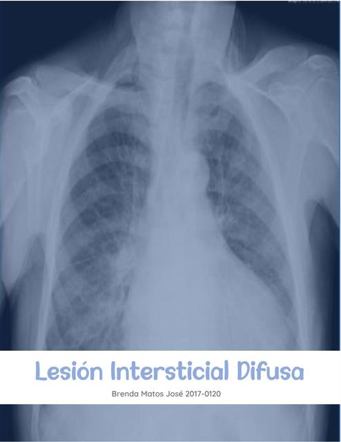 Lesión intersticial difusa | Breenstudy | uDocz
