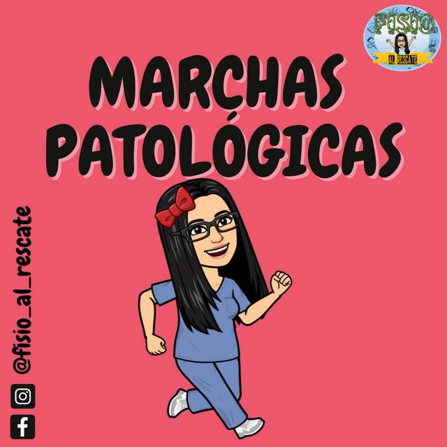 Tipos De Marchas Patologicas Marcha De Segador Miembro Superior En | My ...