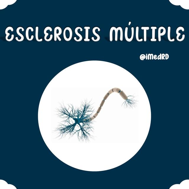 Esclerosis múltiple | uDocz