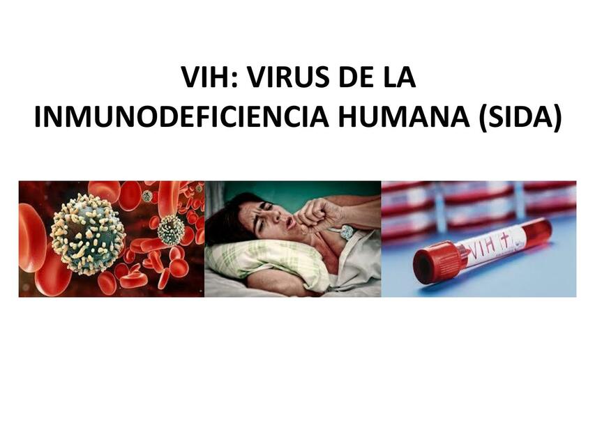 Resúmenes de Virus de Inmunodeficiencia Humana | Descarga apuntes de ...