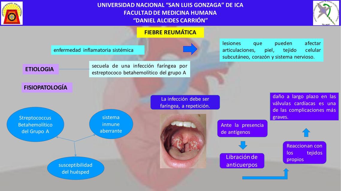 Fiebre Reumática | Fer QuVi | uDocz