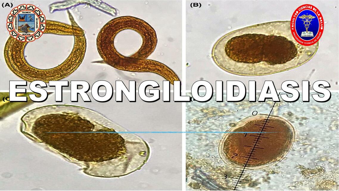 Resúmenes de Estrongiloidiasis | Descarga apuntes de Estrongiloidiasis